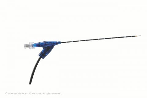 ClosureFast - Island Cardiovascular and Vein Institute