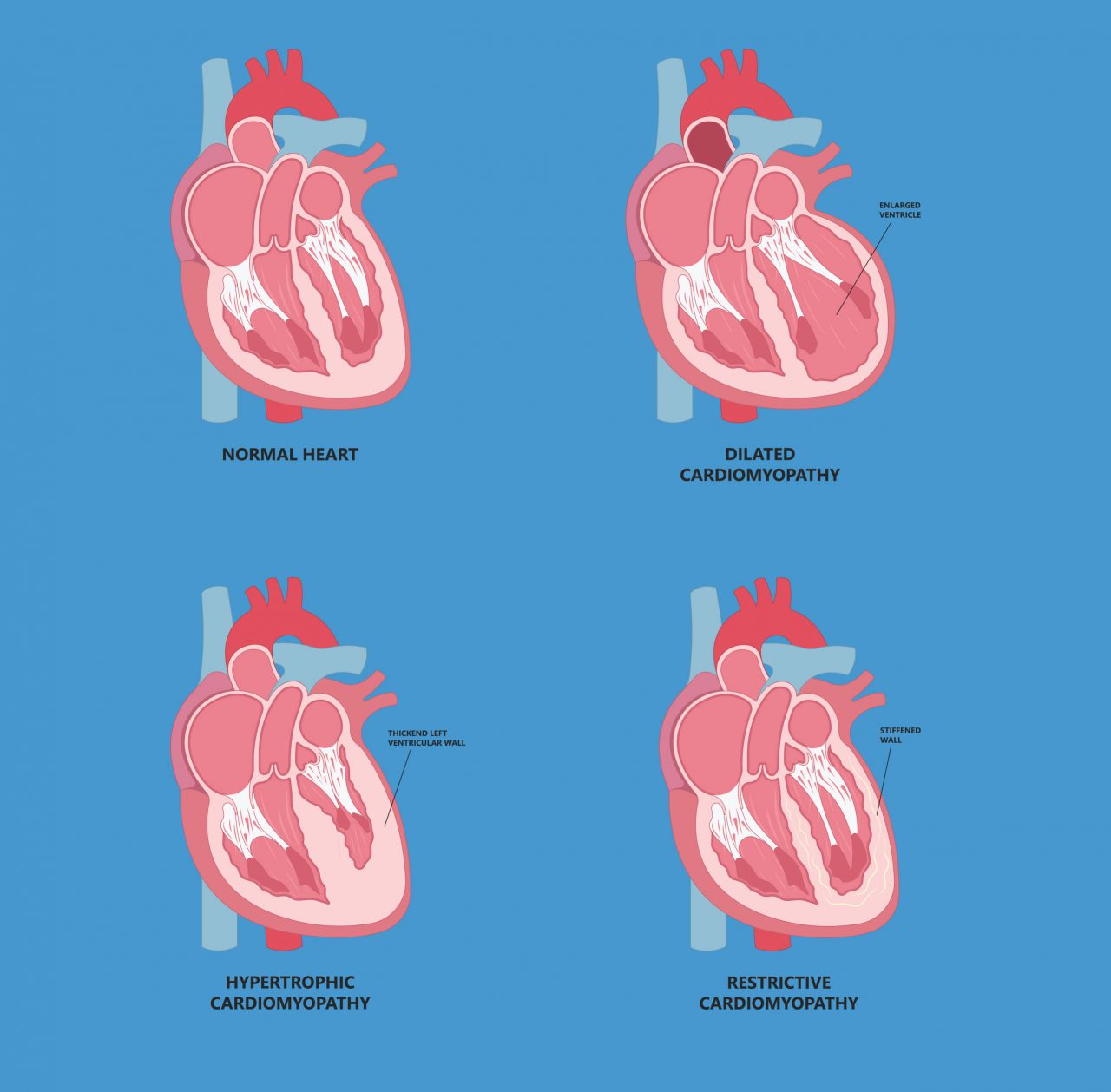 Big Island Hawaii Cardiologist | Island Cardiovascular and Vein
