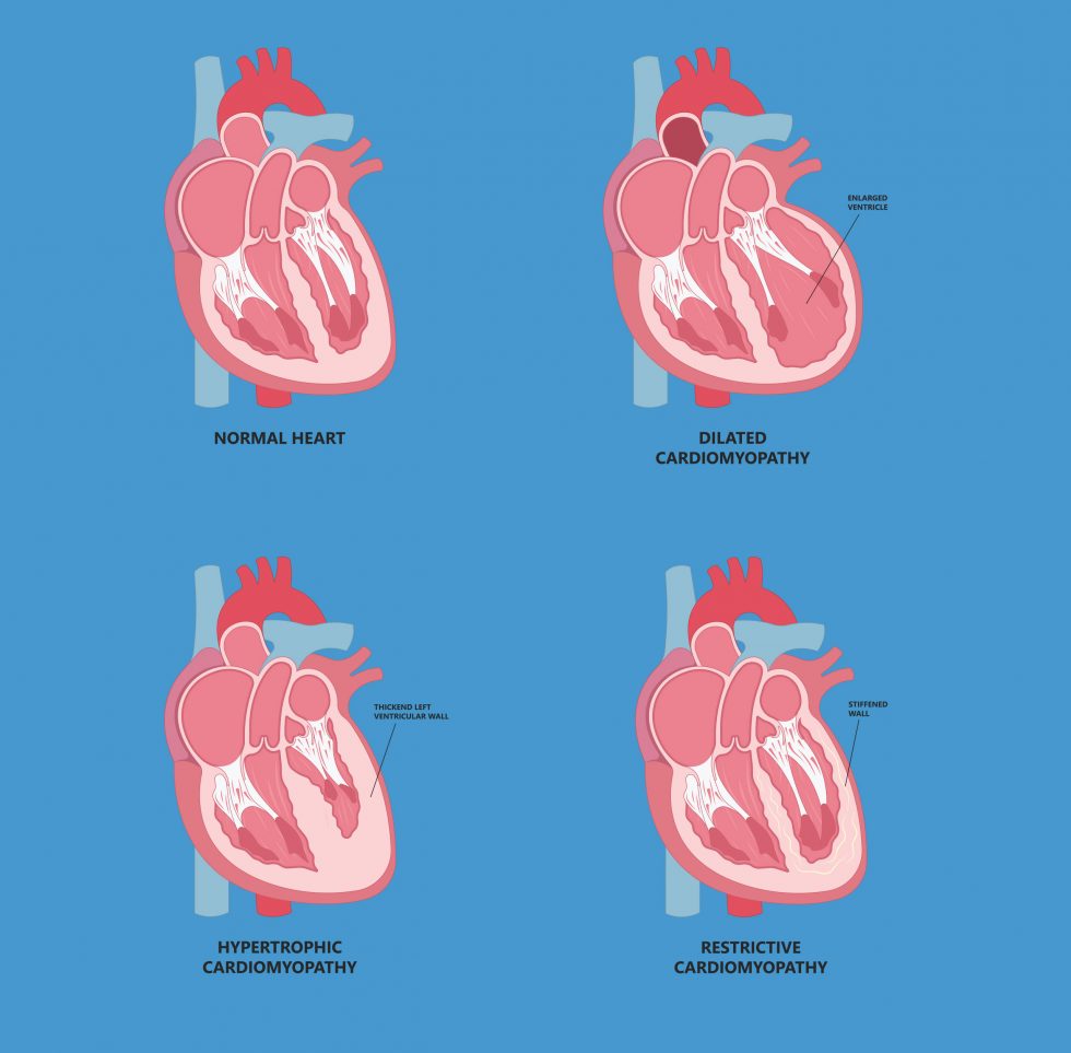 Big Island Hawaii Cardiologist | Island Cardiovascular and Vein