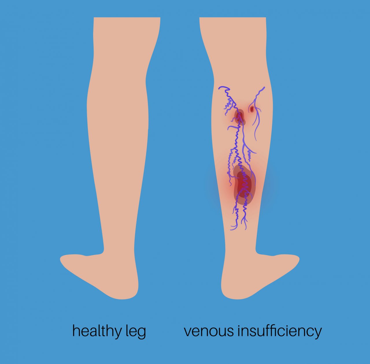 Vein Doctor in Hawaii | Diagnosing and Treating Vein Disease
