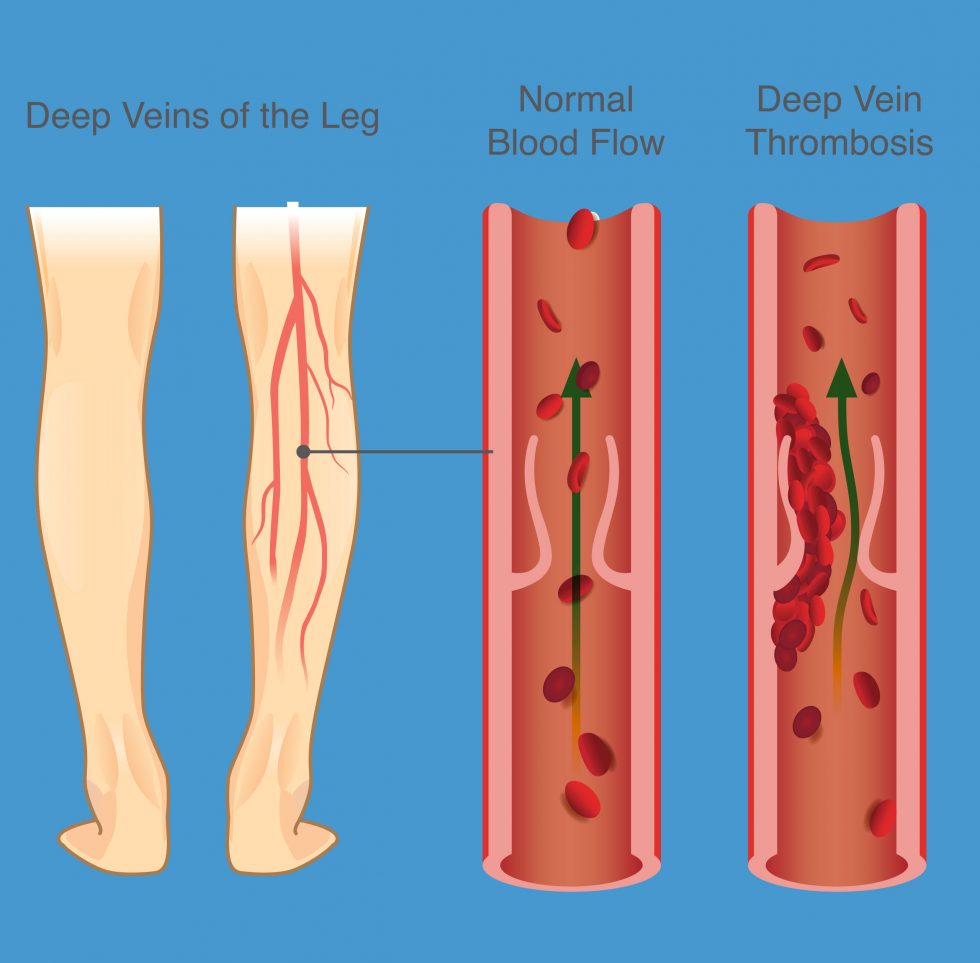 Vein Doctor in Hawaii | Diagnosing and Treating Vein Disease